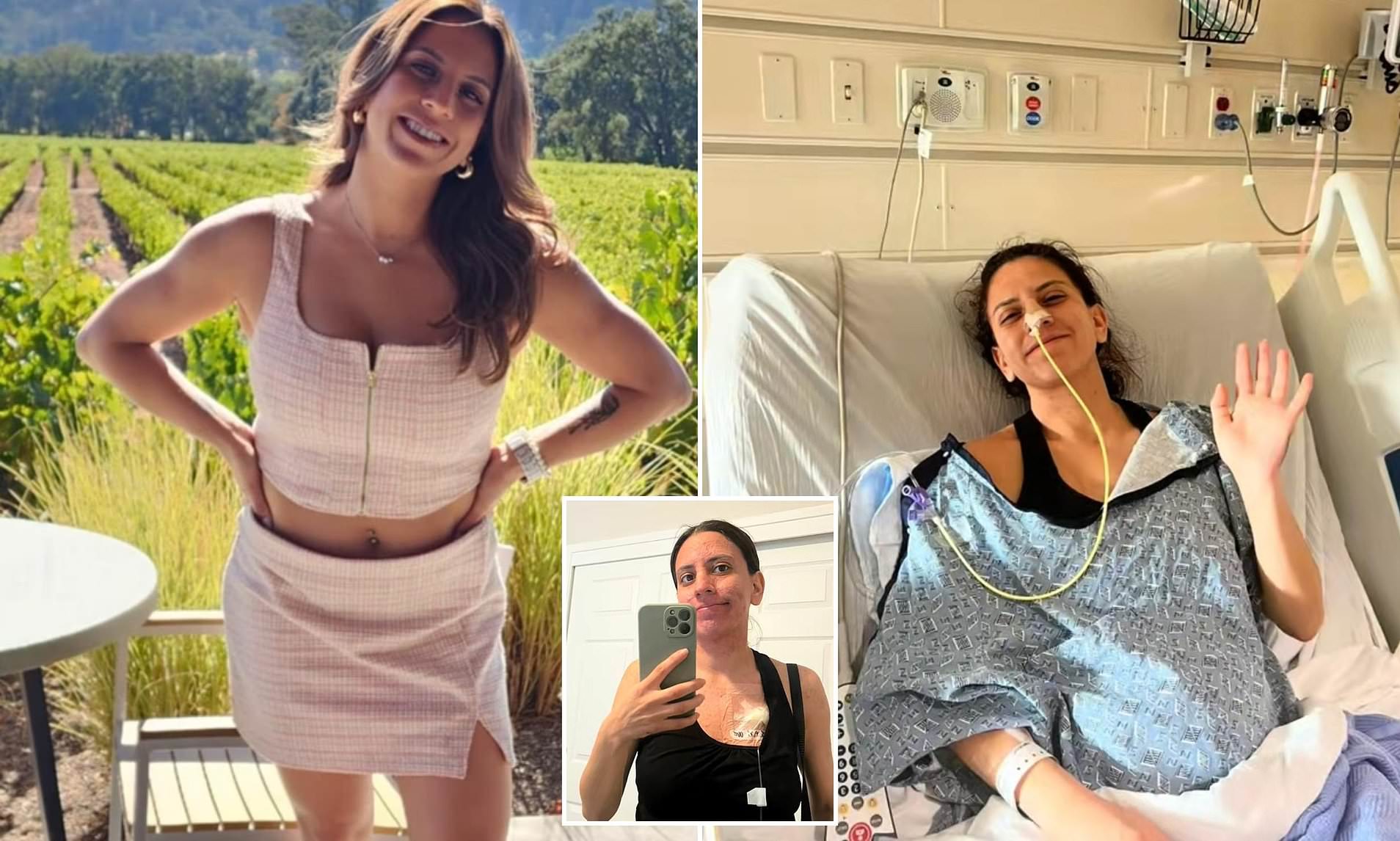Ignoring Stomach Pain During a Half-Marathon Led to Stage 4 Colon ...